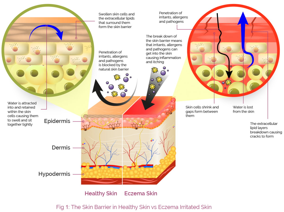 The Skin Barrier The Skin Barrier